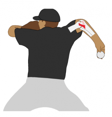 An Evidence-Based Reason Behind Throwing Arm Injuries: Part 3 – ArmCare
